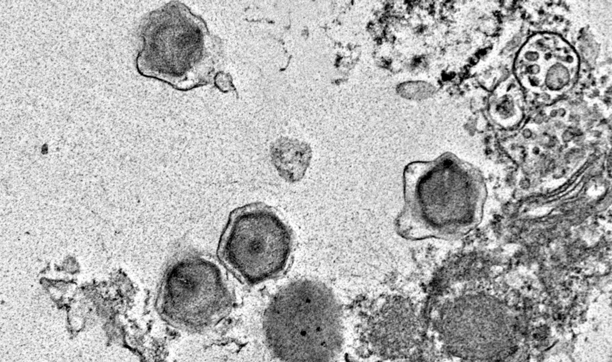 Vandenyne mokslininkai aptiko 230 iki šiol neregėtų patogenų ...