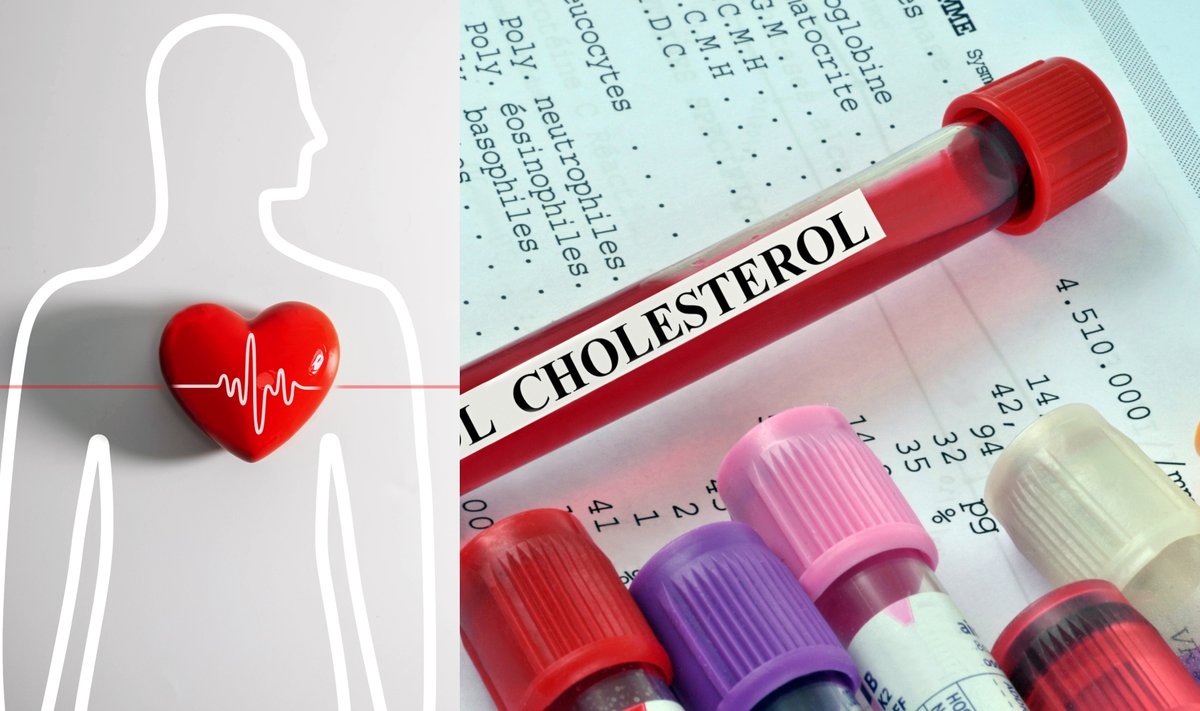 „Gerasis“ ir „blogasis“ cholesterolis: skirtumai ir svarba sveikatai ...