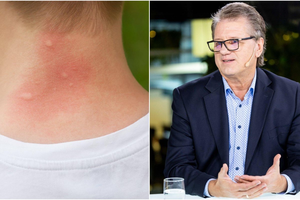 Profesorius Čaplinskas pasidalijo, kaip atpažinti, koks vabalas įgėlė ...
