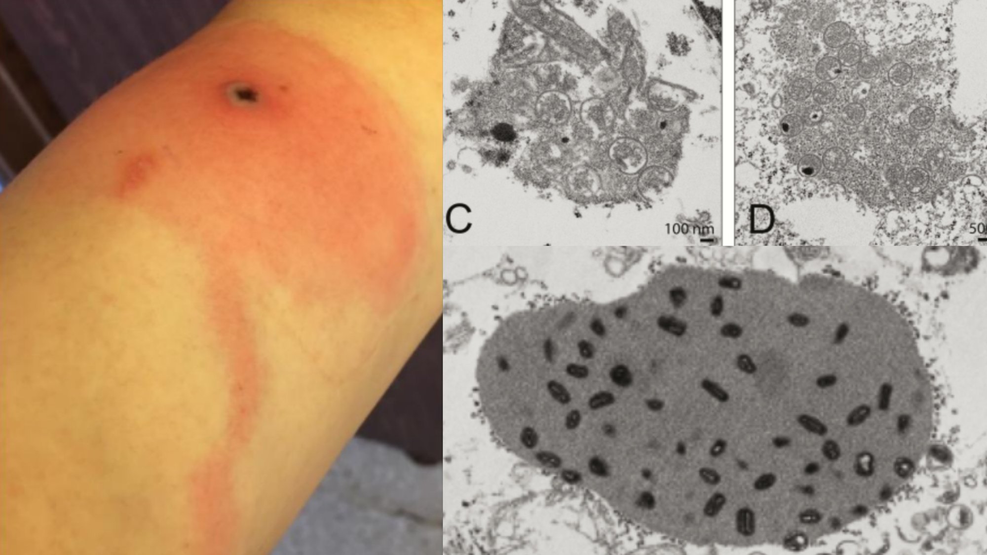 Atkuto retas, bet žmonėms mirtinai pavojingas patogenas: mokslininkai ...