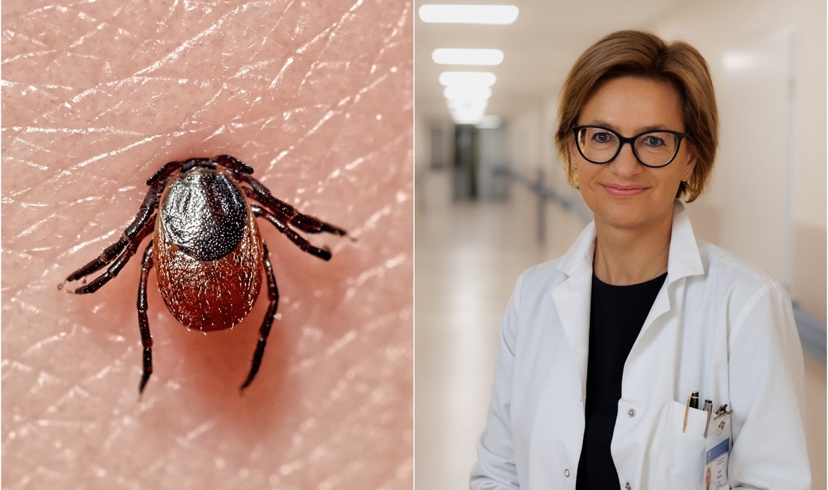 Profesorė – apie Laimo ligą: paaiškino, kodėl nesidaryti kraujo tyrimų ...