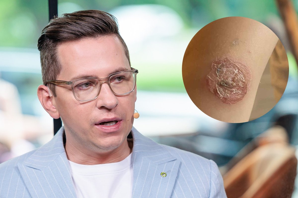 Gydytojas įspėja, kaip užkirsti kelią vandenyje slypinčioms infekcijoms ...