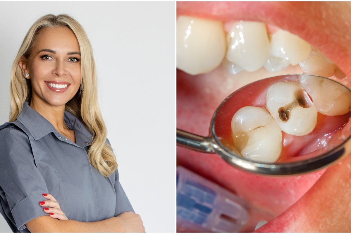 Odontologė paaiškino, kodėl net gerai prižiūrint dantis gresia kariesas ...