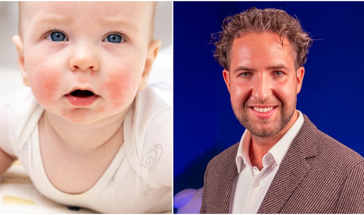 Gydytojas apie uždegiminę vaikų ligą: dažnai tėvai pastebi per vėlai ...