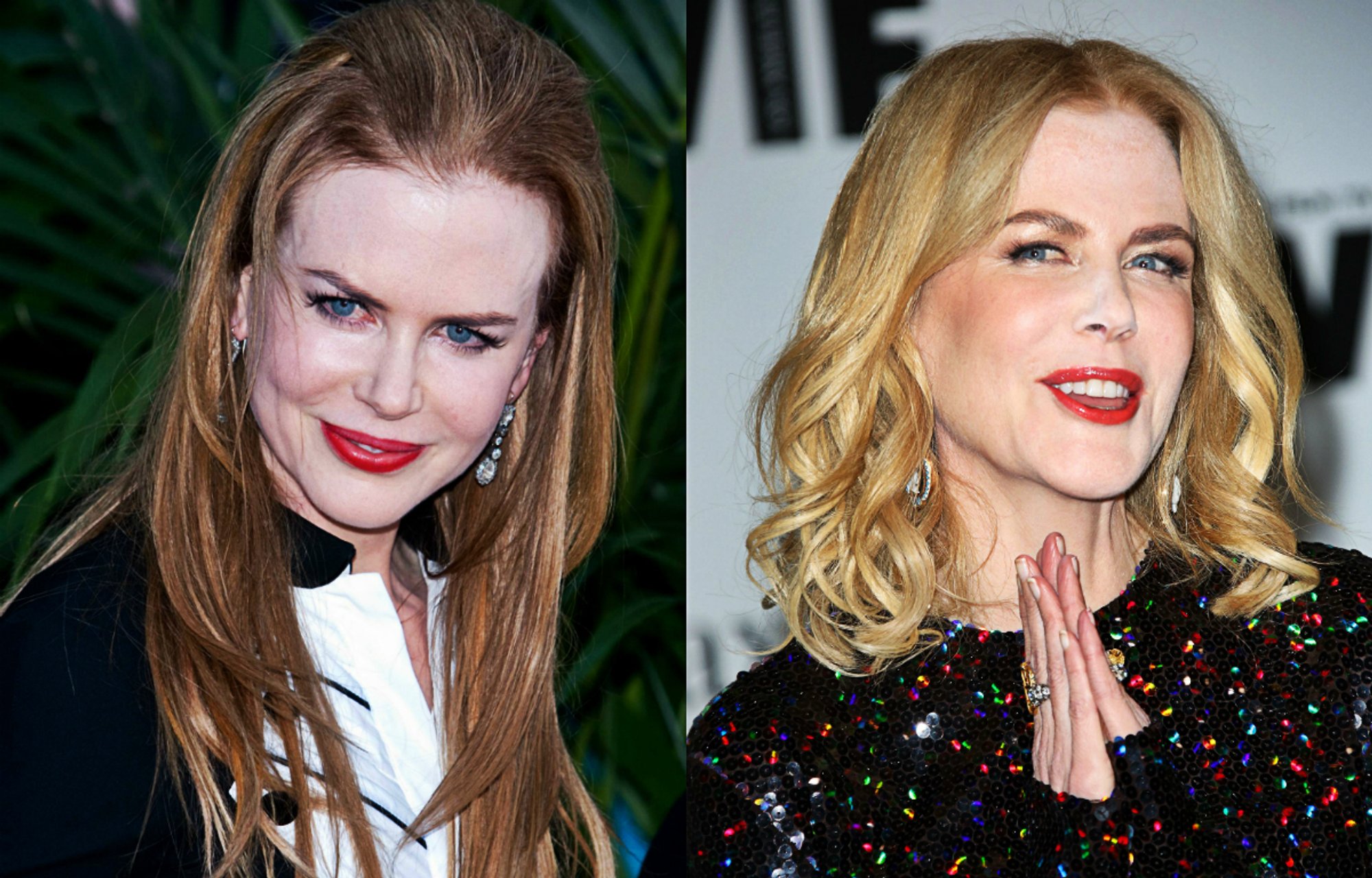 Grožio nesėkmė: kas nutiko Nicole Kidman veidui? FOTO - Delfi gyvenimas