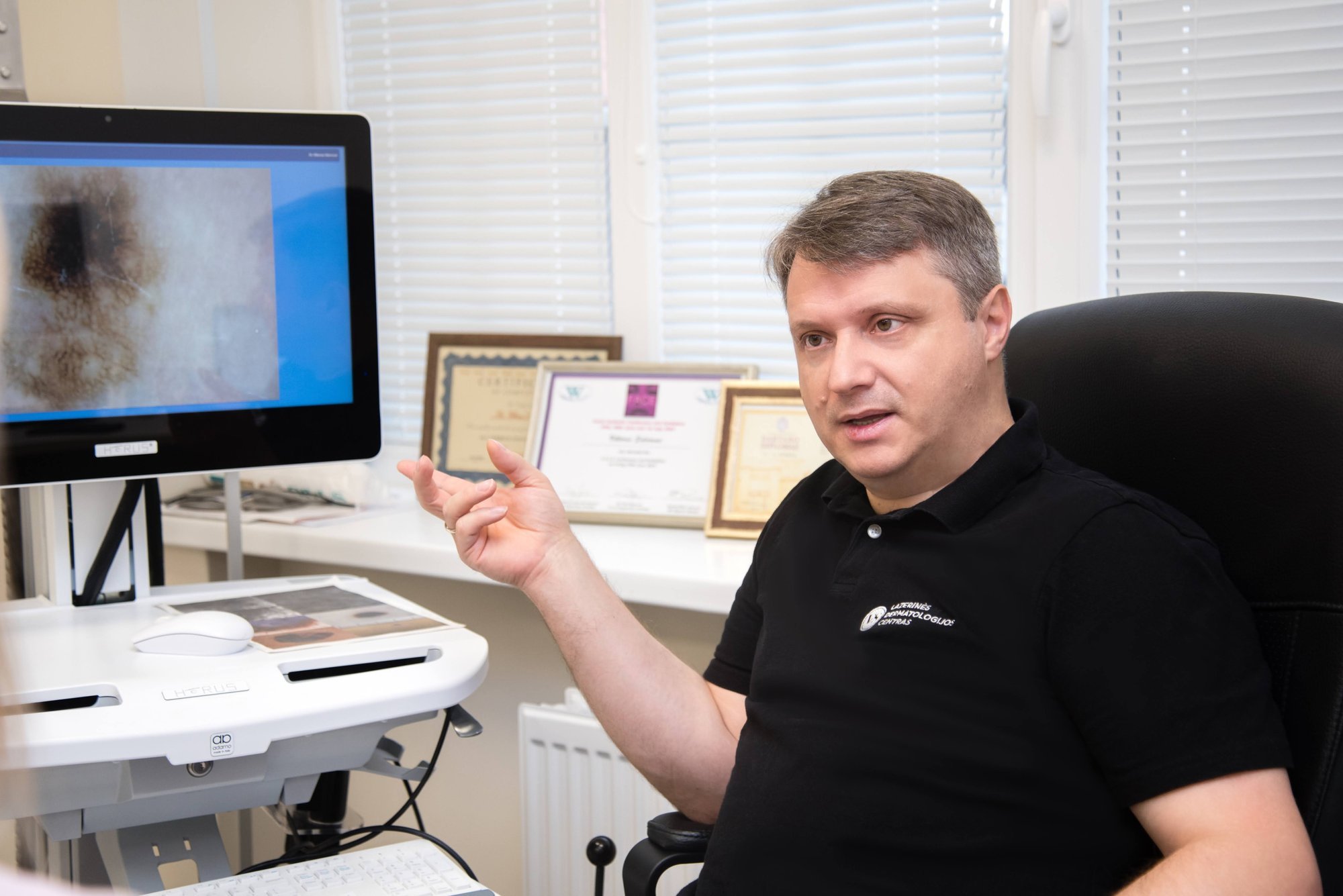 Daktaras papasakojo, kaip odos vėžį galima aptikti net patiems ir ...