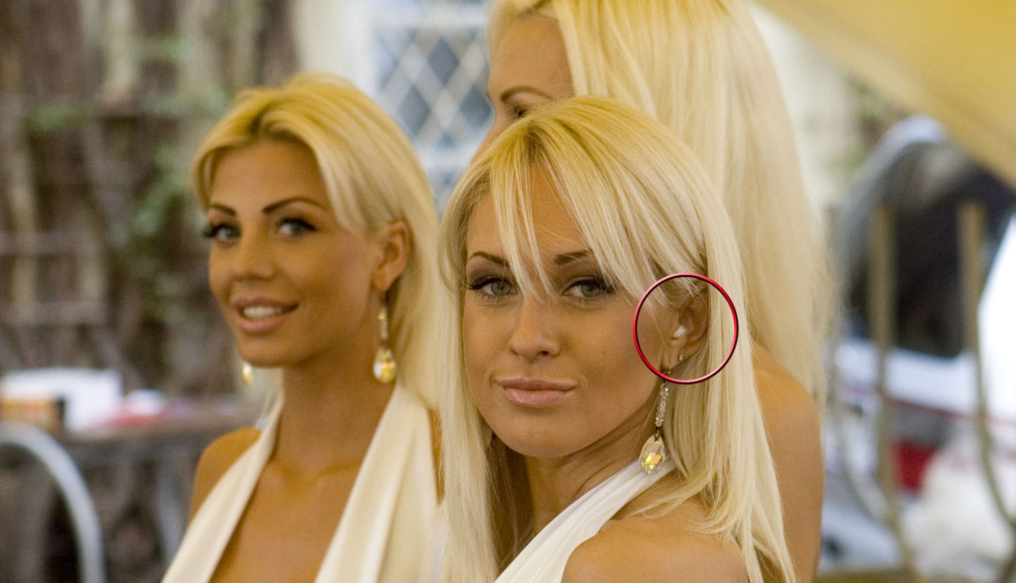 Ausies uždegimas pupytei O. Pikul dainuoti netrukdo (FOTO) - Delfi veidai
