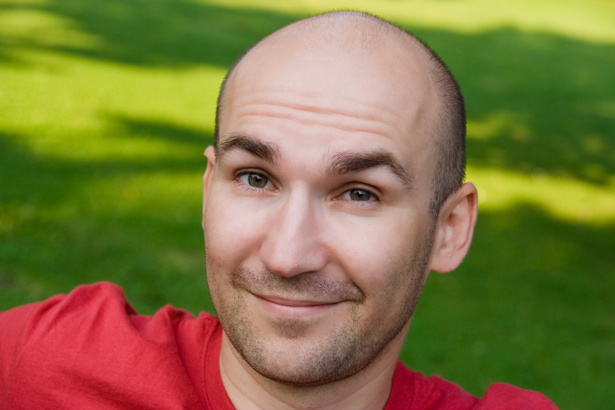 Plaukai ant kojų išgelbės vyrus nuo nuplikimo - Delfi sveikata