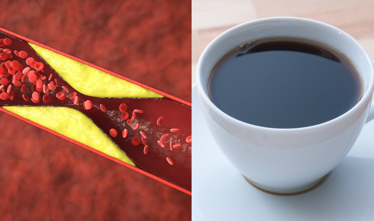 Sveikai maitinuosi, bet cholesterolis vis tiek aukštas: kalti gali būti ...