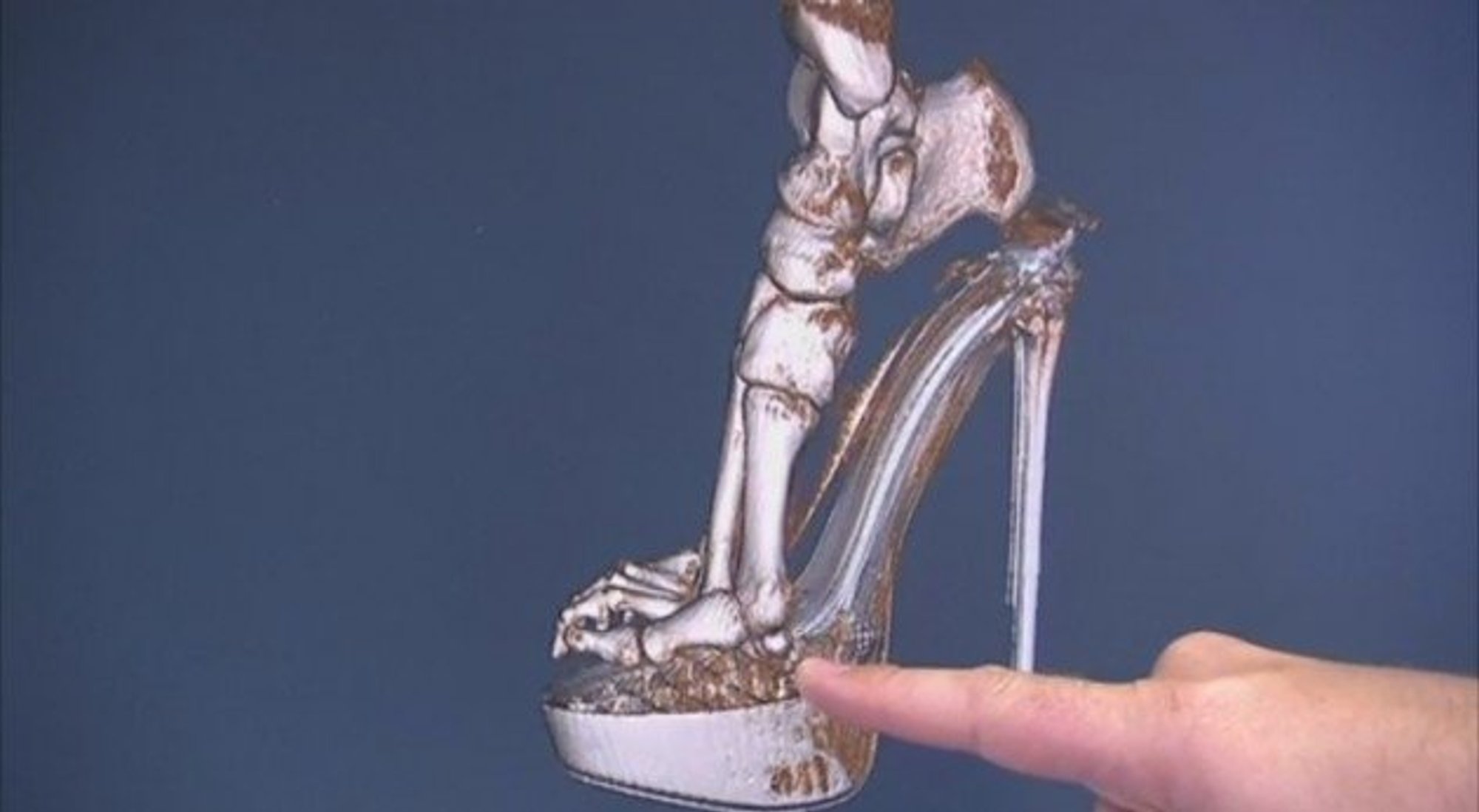 Trimatis aparatas atskleidžia riziką aukštakulnių vergėms - Delfi video