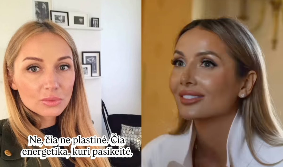 Akivaizdūs Monikos Ra išvaizdos pokyčiai kelia klausimą: tikina, kad ...