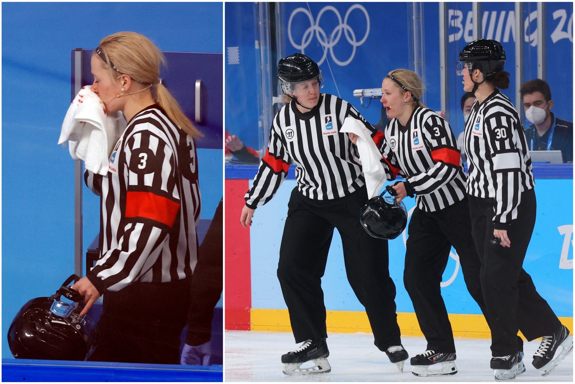 Ledo ritulio lazda per veidą – krauju pasruvusiai teisėjai prireikė ...