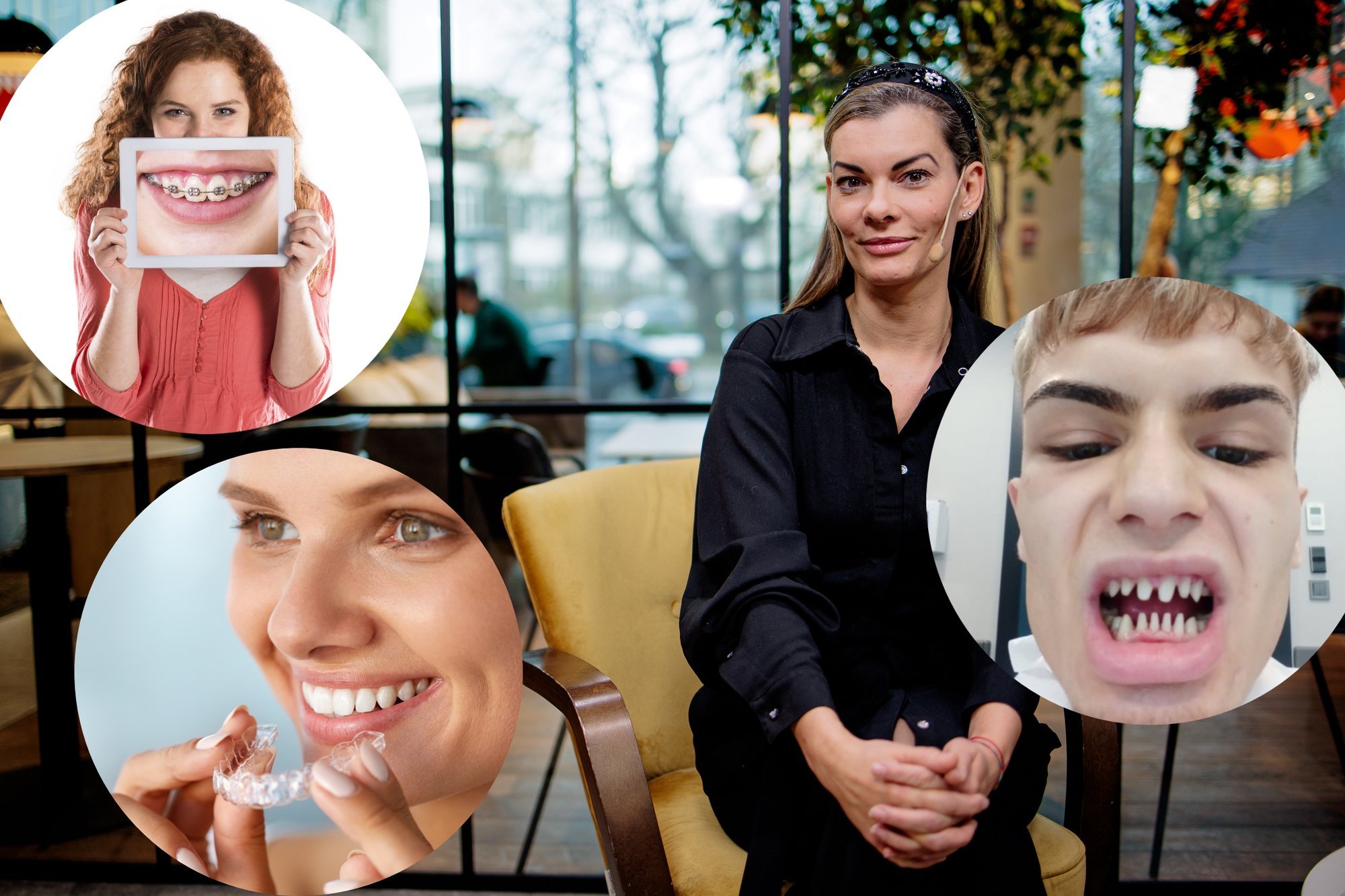 Sveikatos receptas. Ortodontė: išsitiesinus dantis visą gyvenimą teks ...