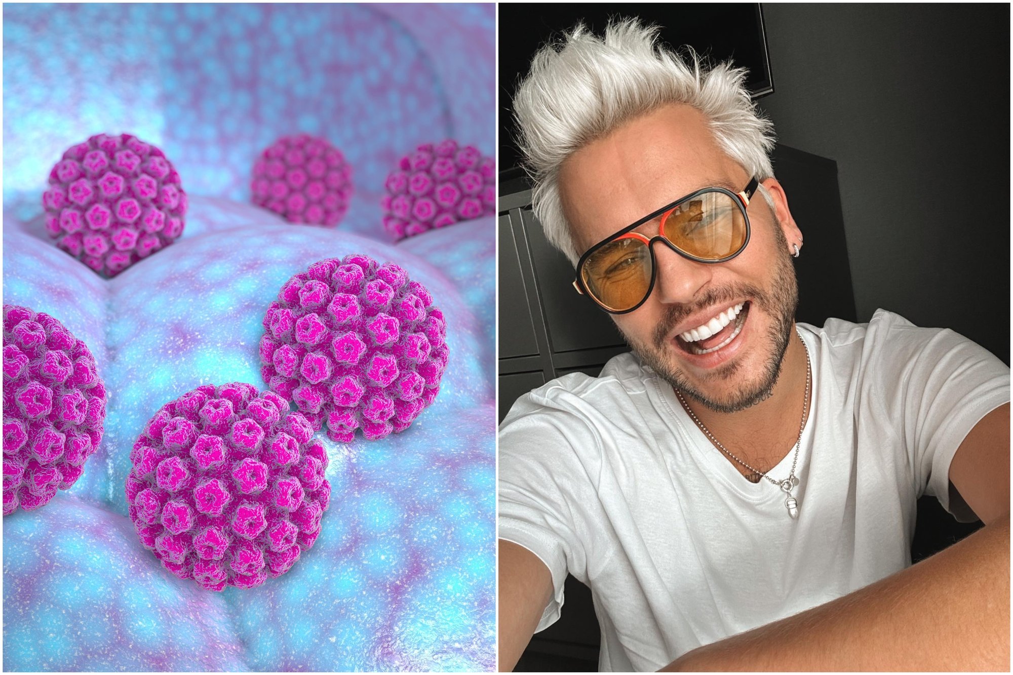 Sužinojęs apie žmogaus papilomos viruso grėsmes, Lukas Gricius ...