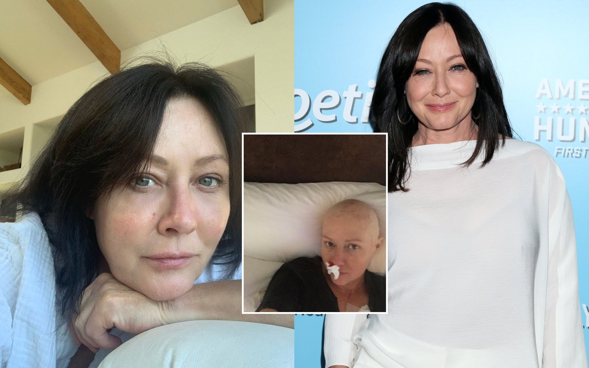 Shannen Doherty parodė kovą su paskutinę stadiją pasiekusiu vėžiu: tai ...