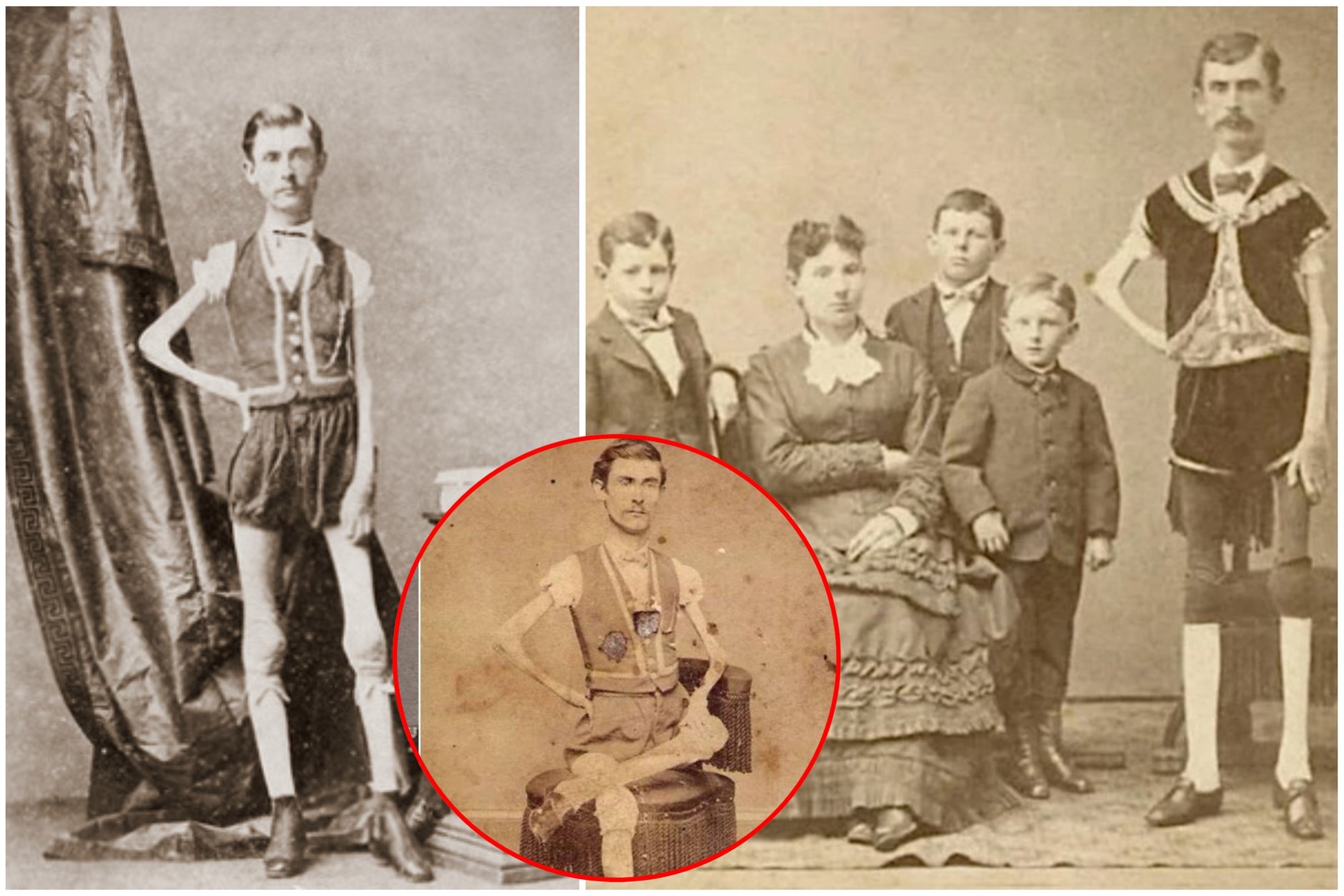 Vos 20 kg svorio vyras buvo pramintas gyvu skeletu: nors smalsuoliai ...