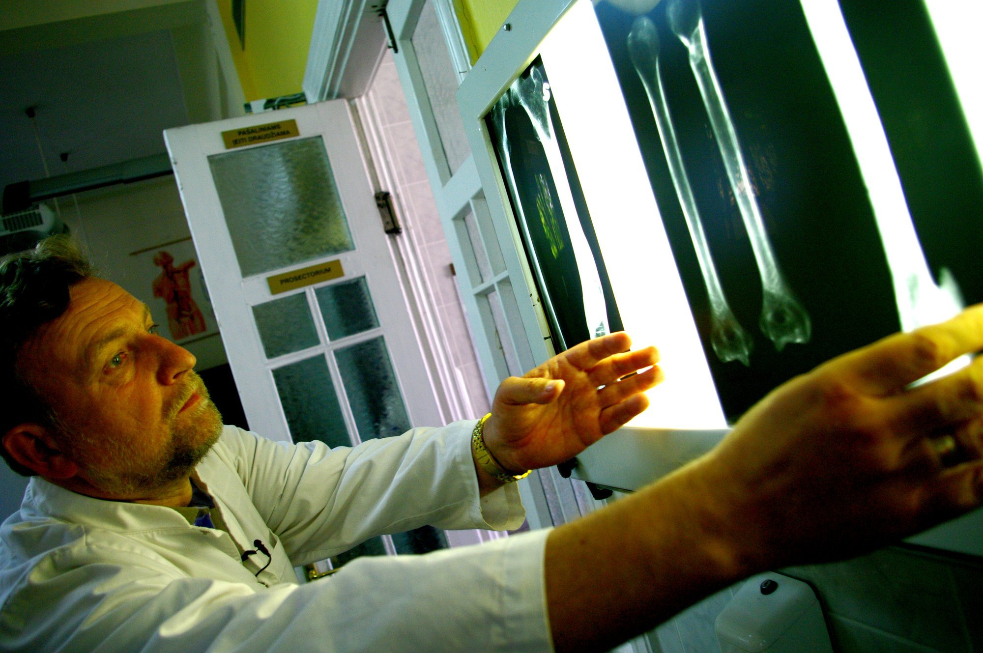 Mokslininkai: kaulų lūžių gydymo metodai nesikeitė pusantro tūkstančio ...