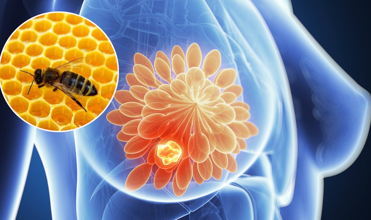 Mokslininkai: bičių nuodai gali sunaikinti vėžio ląsteles - Delfi gyvenimas